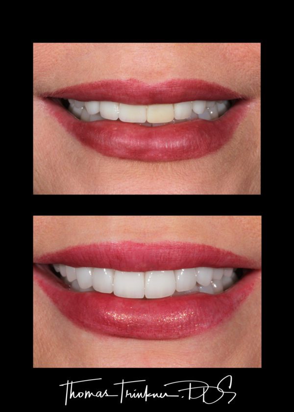 View Portfolio Of Dental Work by Columbia SC Dentist Dr. Trinkner